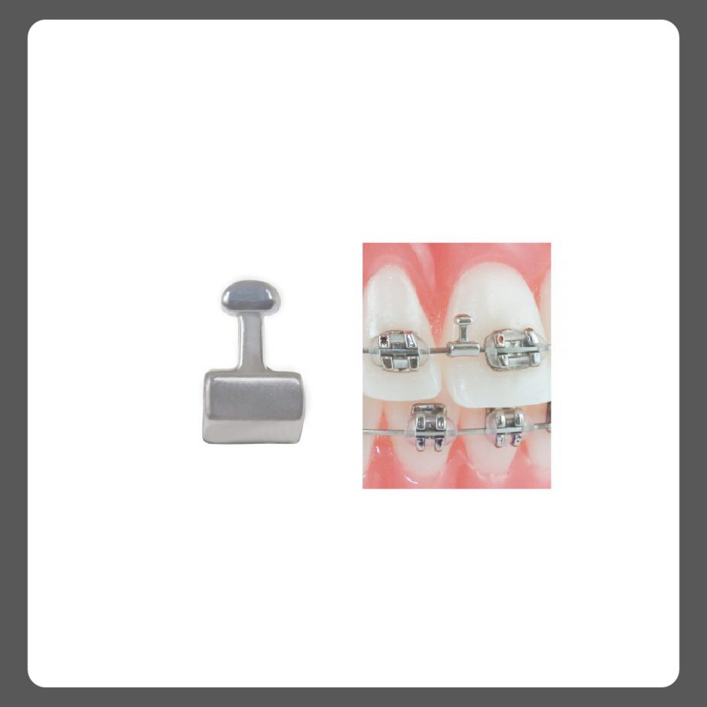 Bi-directional hooks-short crimp .022x.025 20's - SA Dental